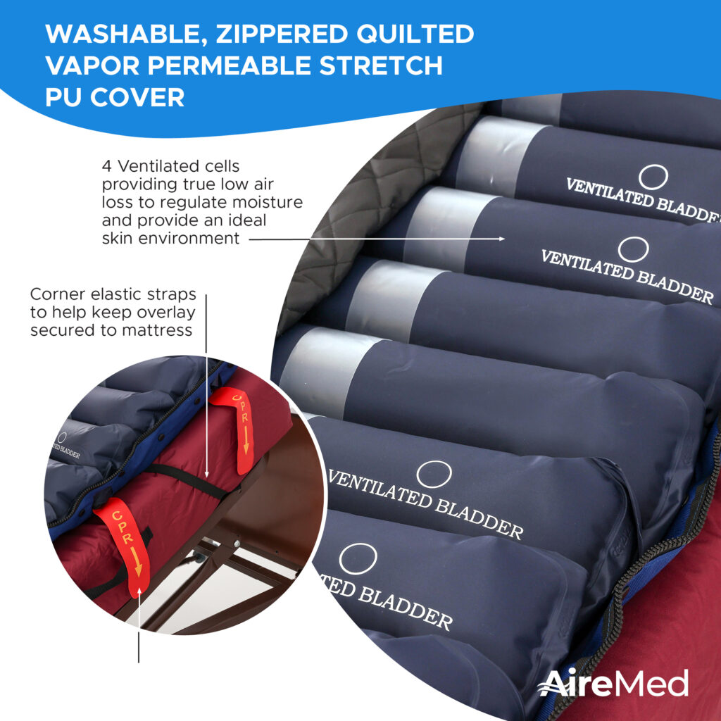 AireMed 5” Low Air Loss & Alternating Pressure Mattress Overlay System ...